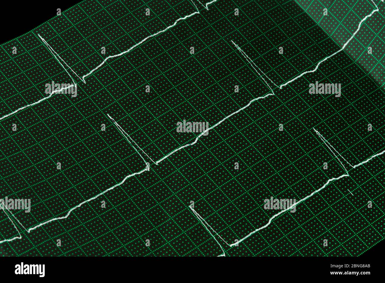Close up of an electrocardiogram in paper form. Medical healthcare ...