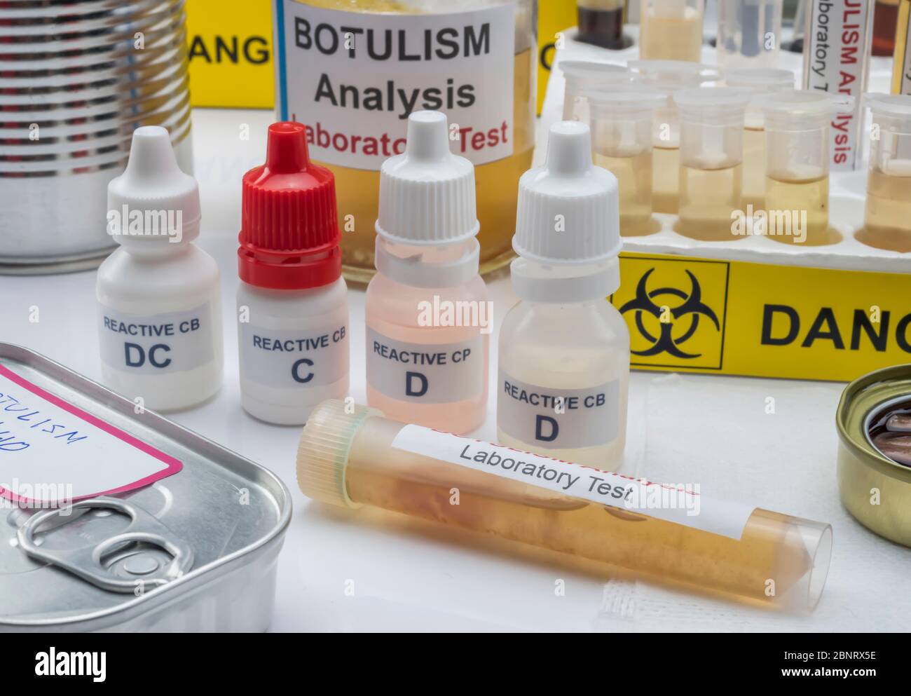 Samples contaminated by Clostridium botulinum toxin that causes ...