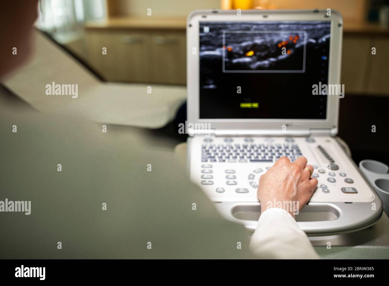 Ultrasound diagnostic machine hi-res stock photography and images - Alamy