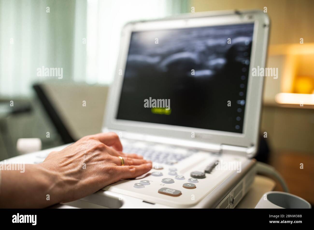 Ultrasound diagnostic machine hi-res stock photography and images - Alamy