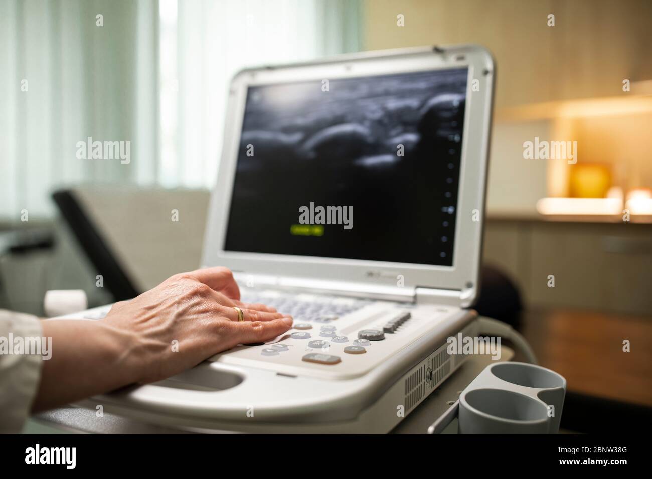 Close up shot of technician operating an ultrasound machine at a clinic ...