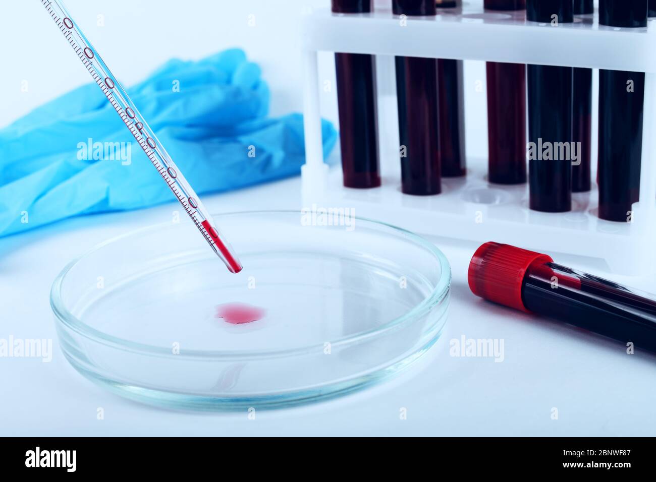 petri dish and glass dropper on a laboratory bench, toned blue color ...