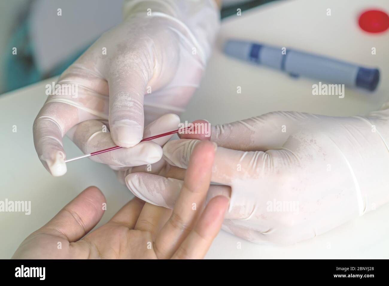 Hematocrit capillary tubes hi-res stock photography and images - Alamy