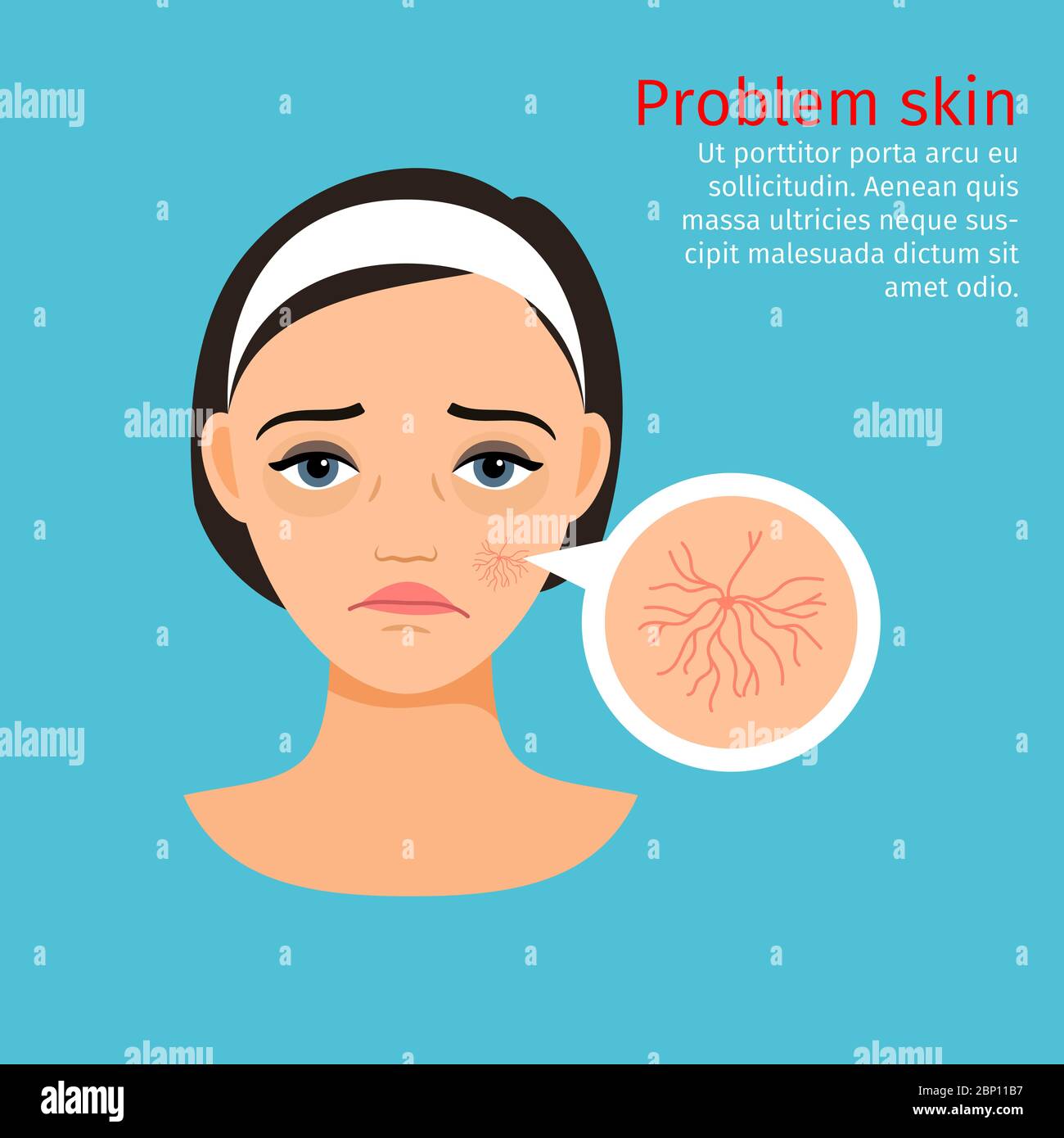 Edema face hi-res stock photography and images - Alamy