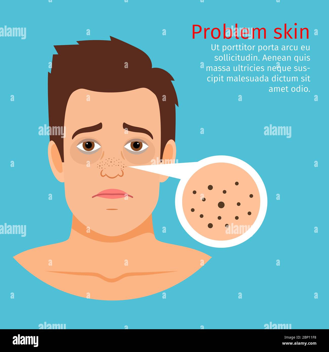 Young man face problem skin with black dots, vector illustration Stock ...