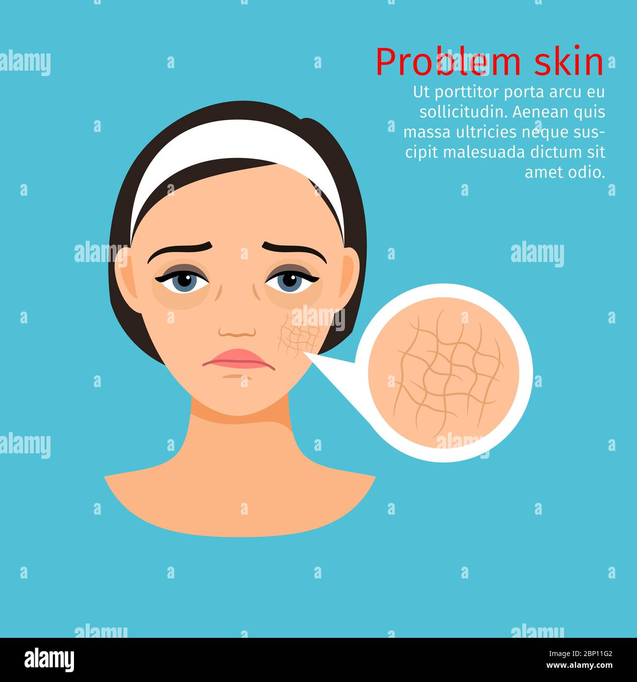 Woman face with dry skin problem, vector illustration Stock Vector ...