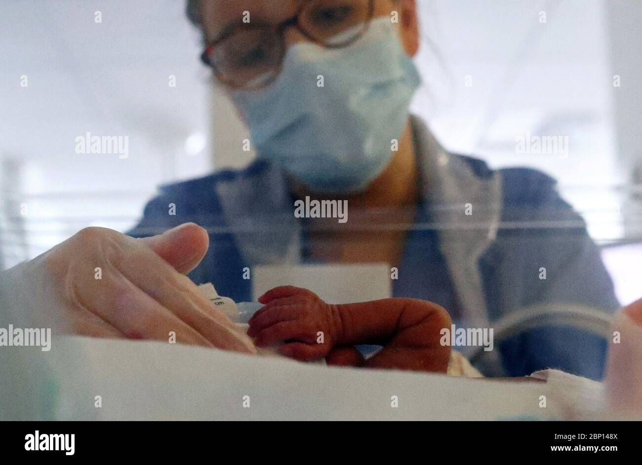 Premature baby theo anderson hi-res stock photography and images - Alamy