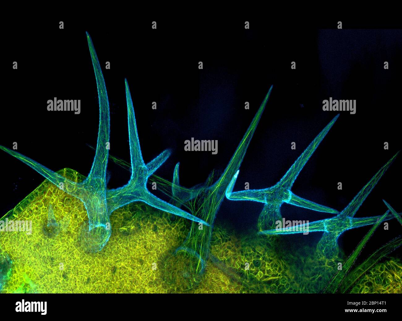 Fluorescently labeled microfilaments in Arabidopsis trichomes and ...