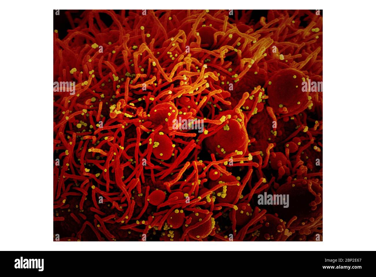 Novel Coronavirus SARS-CoV-2Colorized scanning electron micrograph of ...
