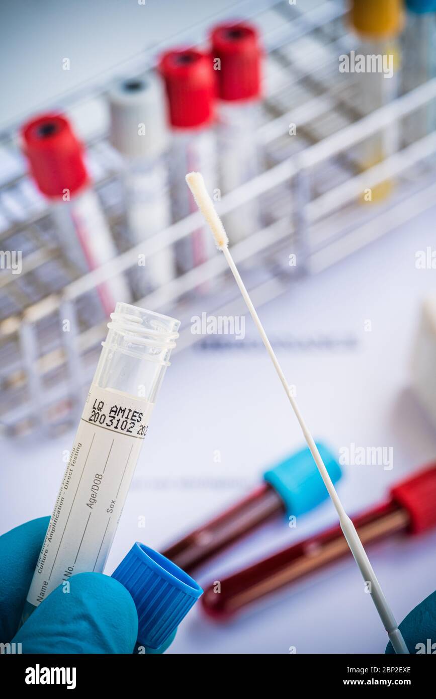 Serology tests hi-res stock photography and images - Alamy