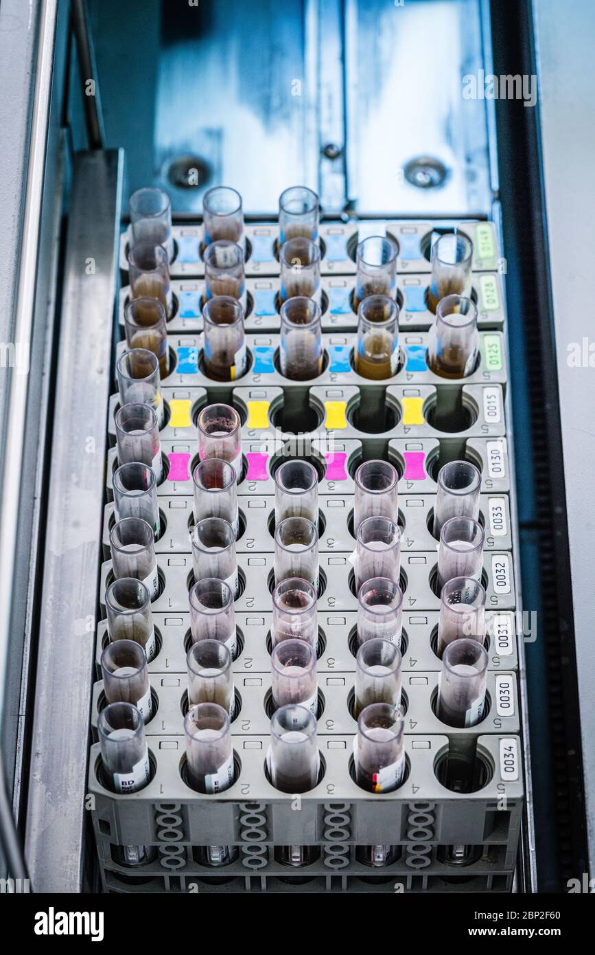 Blood samples from serological tests for the detection of antibodies ...