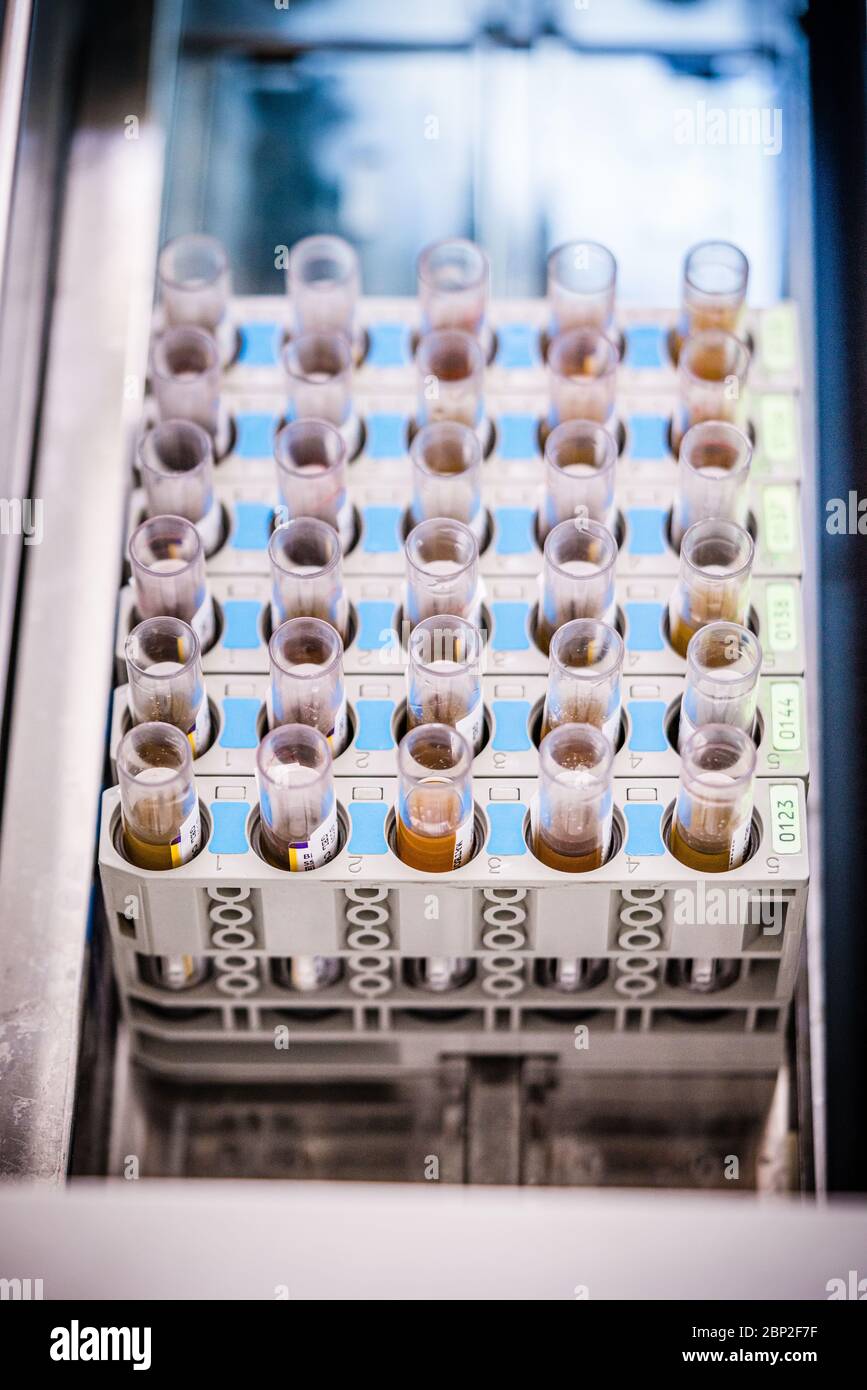 Blood samples from serological tests for the detection of antibodies ...