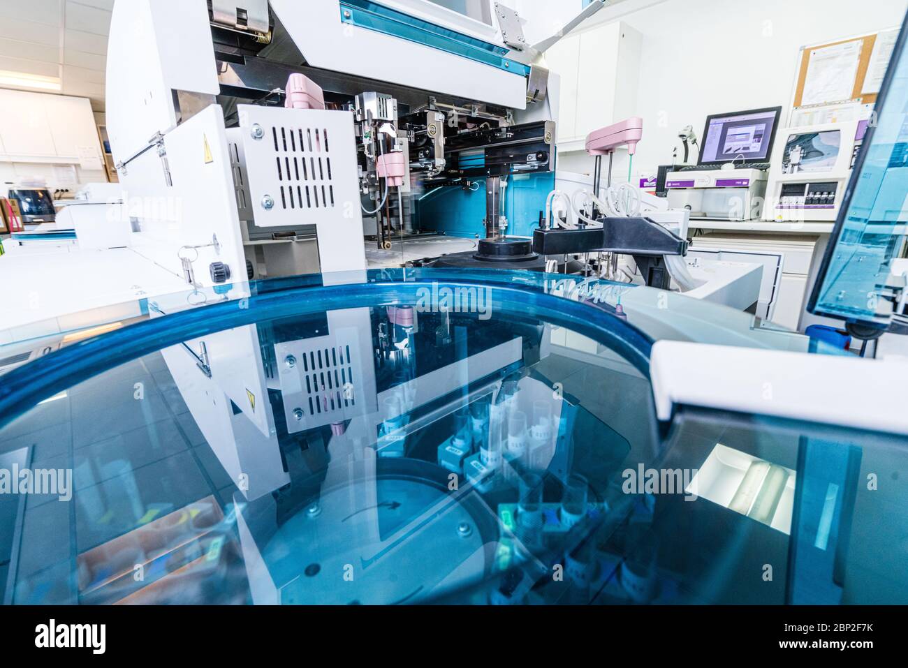 Automated serological testing machine for the detection of antibodies ...