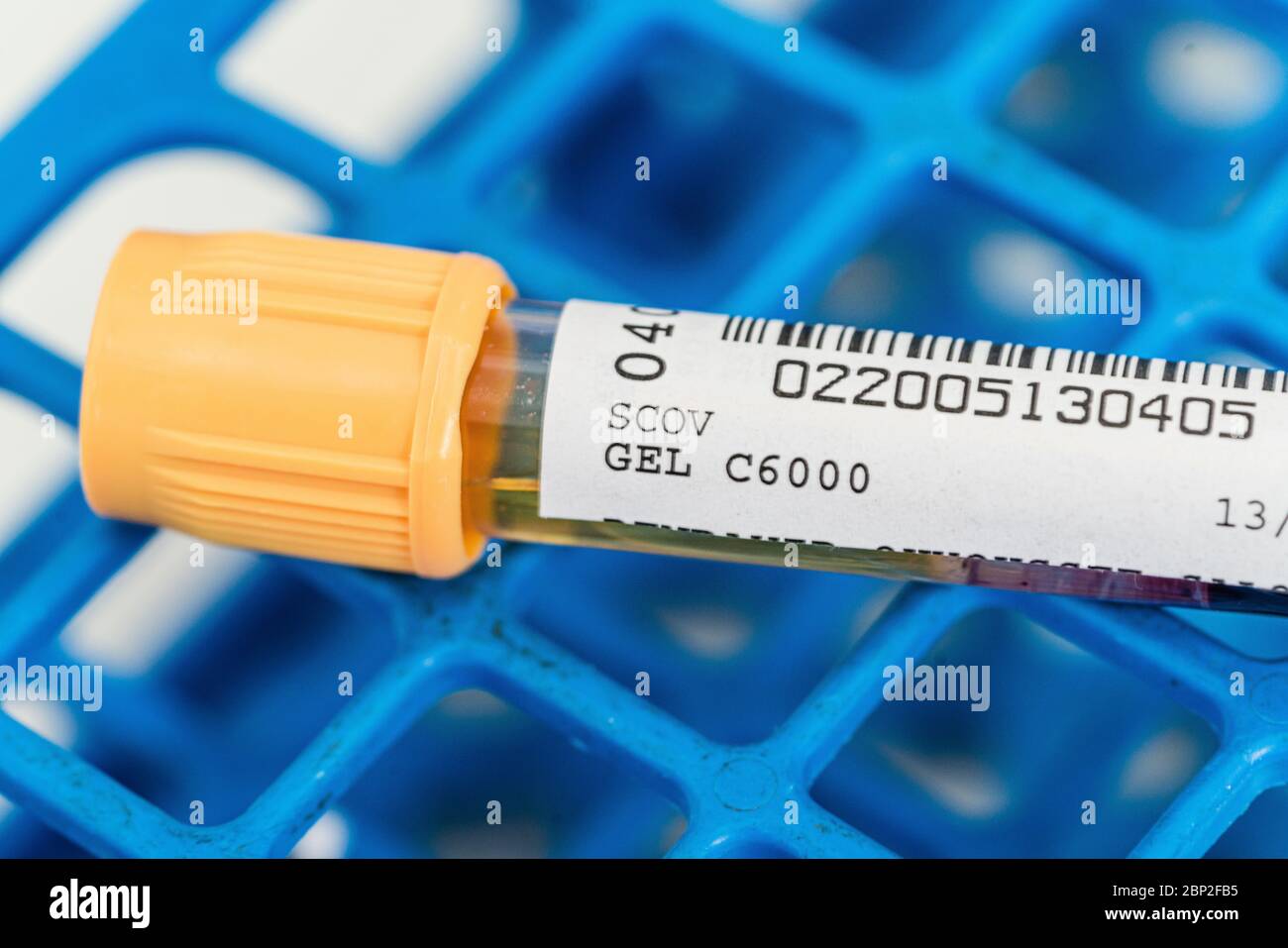 Blood sample, Covid 19 serological test of a patient wishing to know if ...