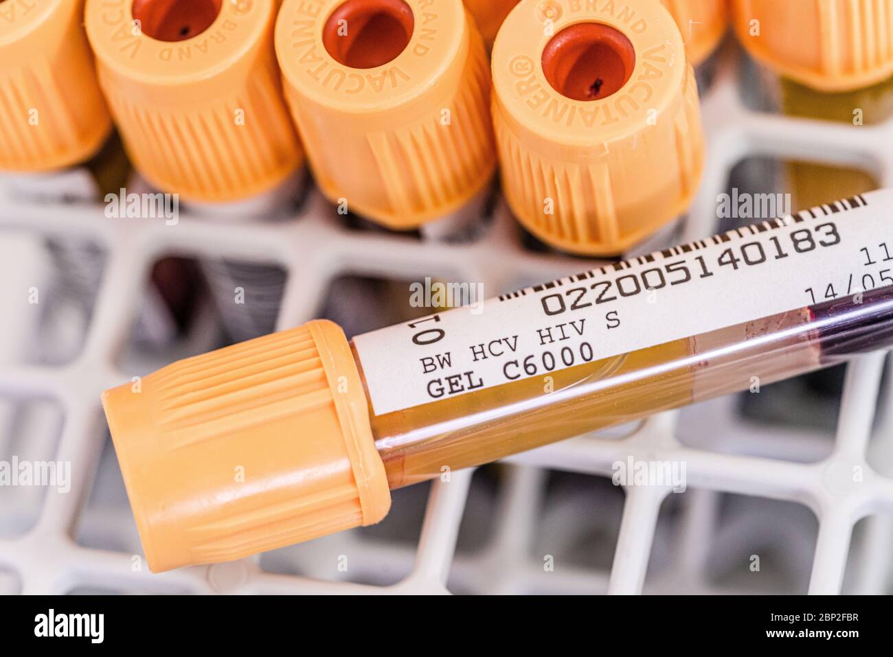 Blood test, syphilis serology, HIV AND hepatitis C Stock Photo - Alamy