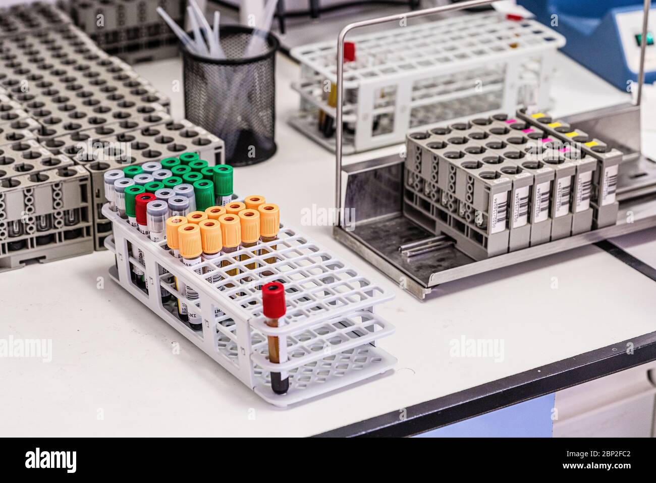 Blood samples from serological tests for the detection of antibodies ...