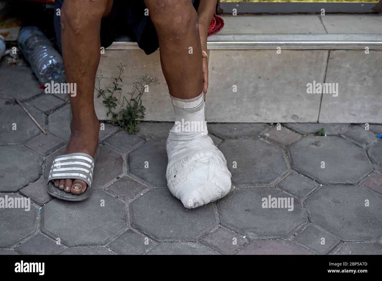 Bandaged man hi-res stock photography and images - Alamy