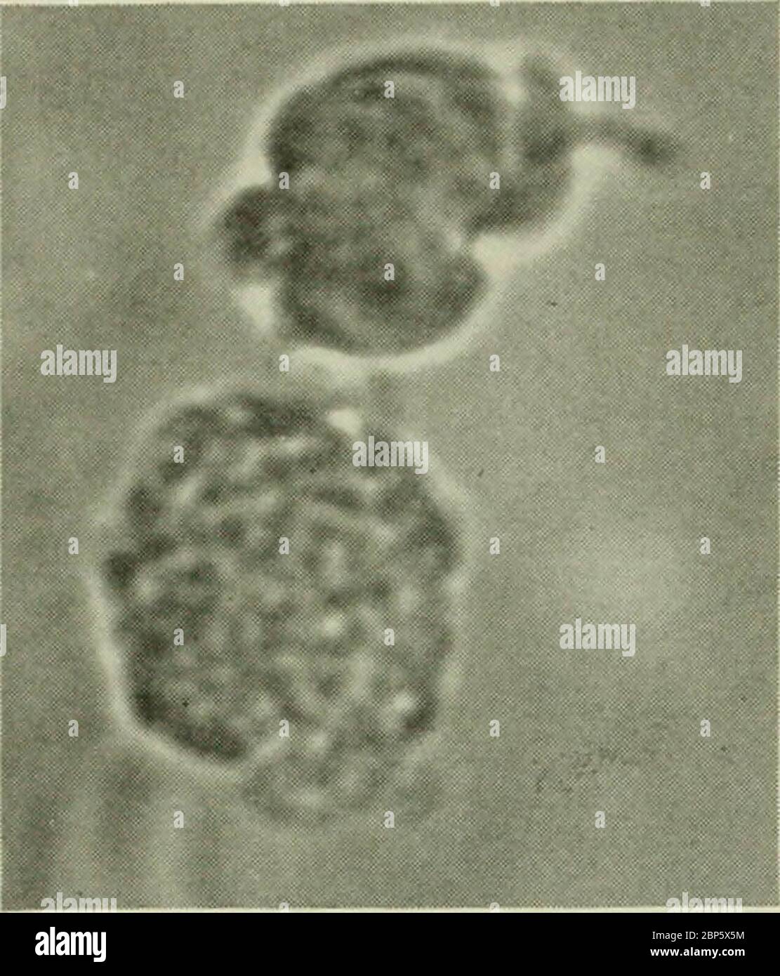 Actinomycetes hi-res stock photography and images - Alamy