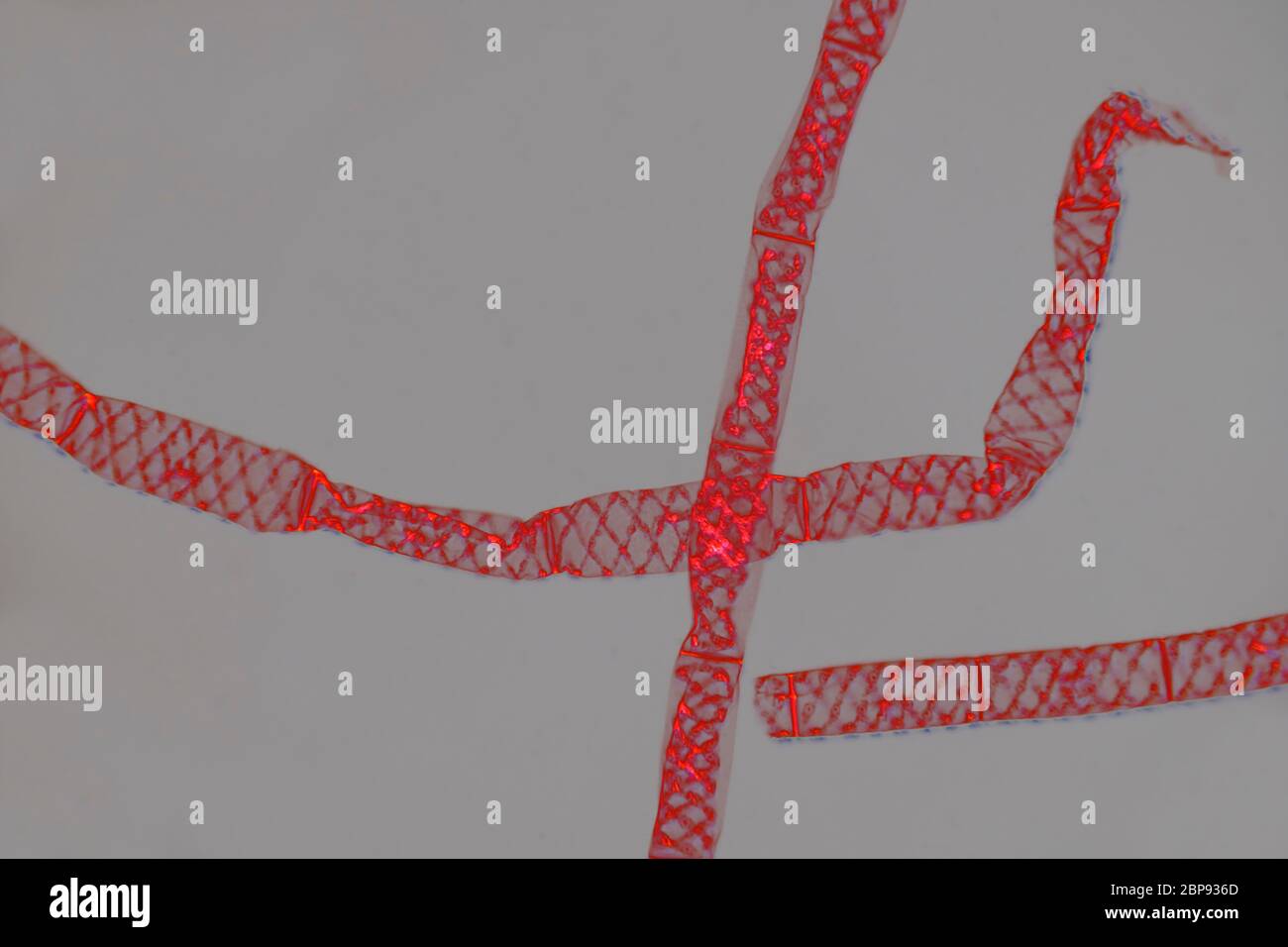 Spirogyra algae, microscope view Stock Photo - Alamy