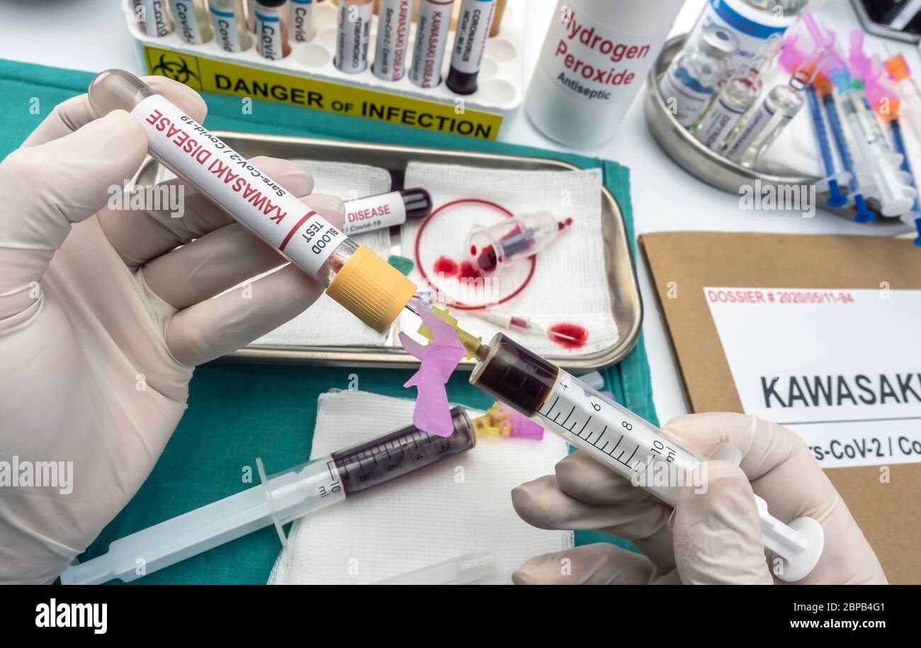 Nurse draws blood sample to treat Sars-CoV-2-related Kawasaki disease ...