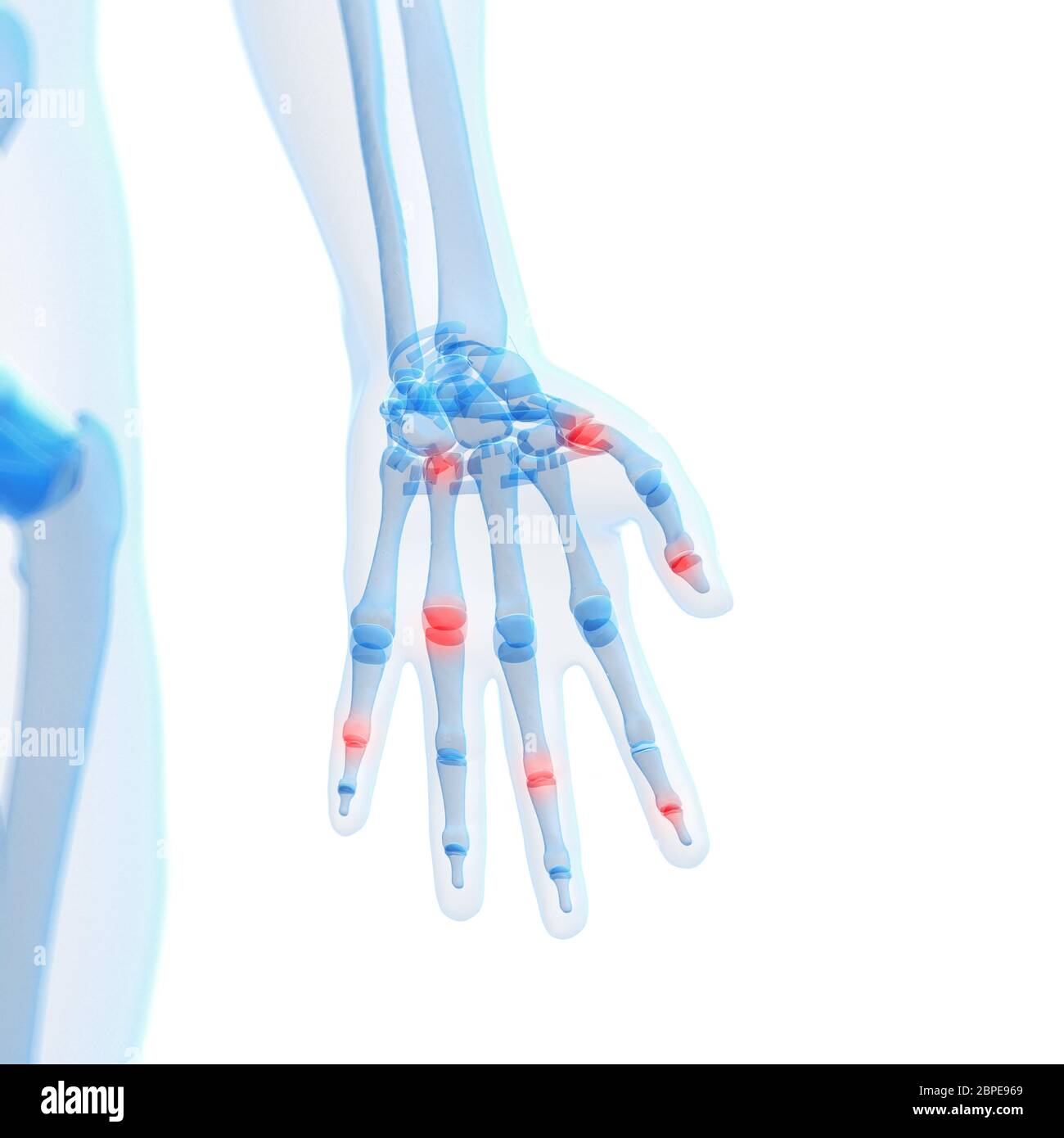 Painful finger joints hi-res stock photography and images - Alamy