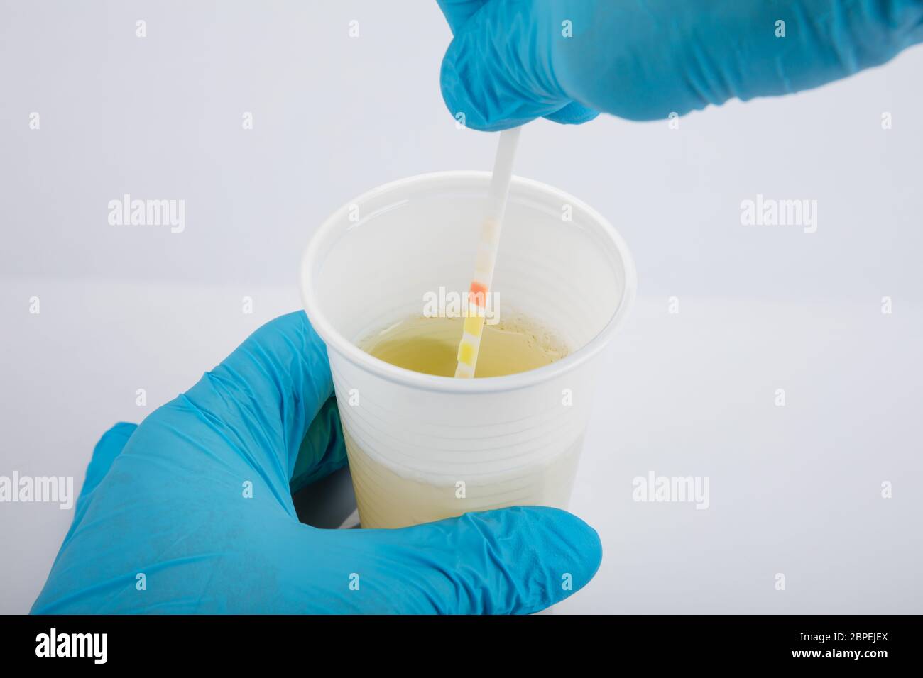 Medical Urine Test Examined By Doctor With The Help Of Urine Test Strip ...