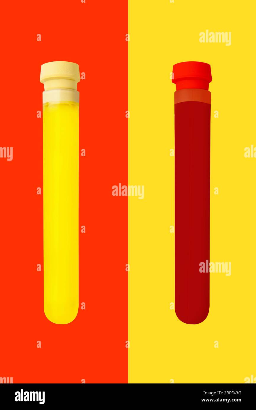 Biohacking. Urine and blood testing Stock Photo - Alamy