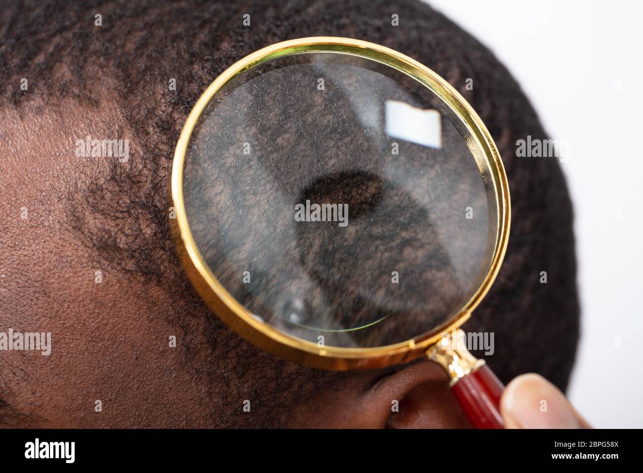 Close-up Of Man's Hair Seen Through Transparent Magnifying Glass Stock ...