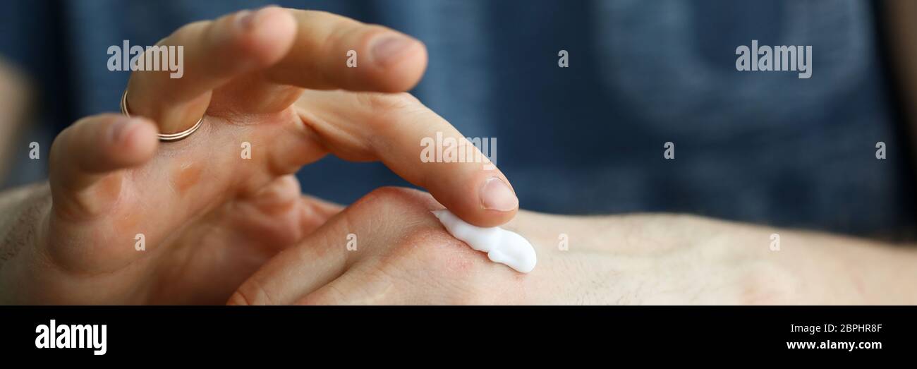 Male hard hands with calluses apply moisturizer Stock Photo - Alamy