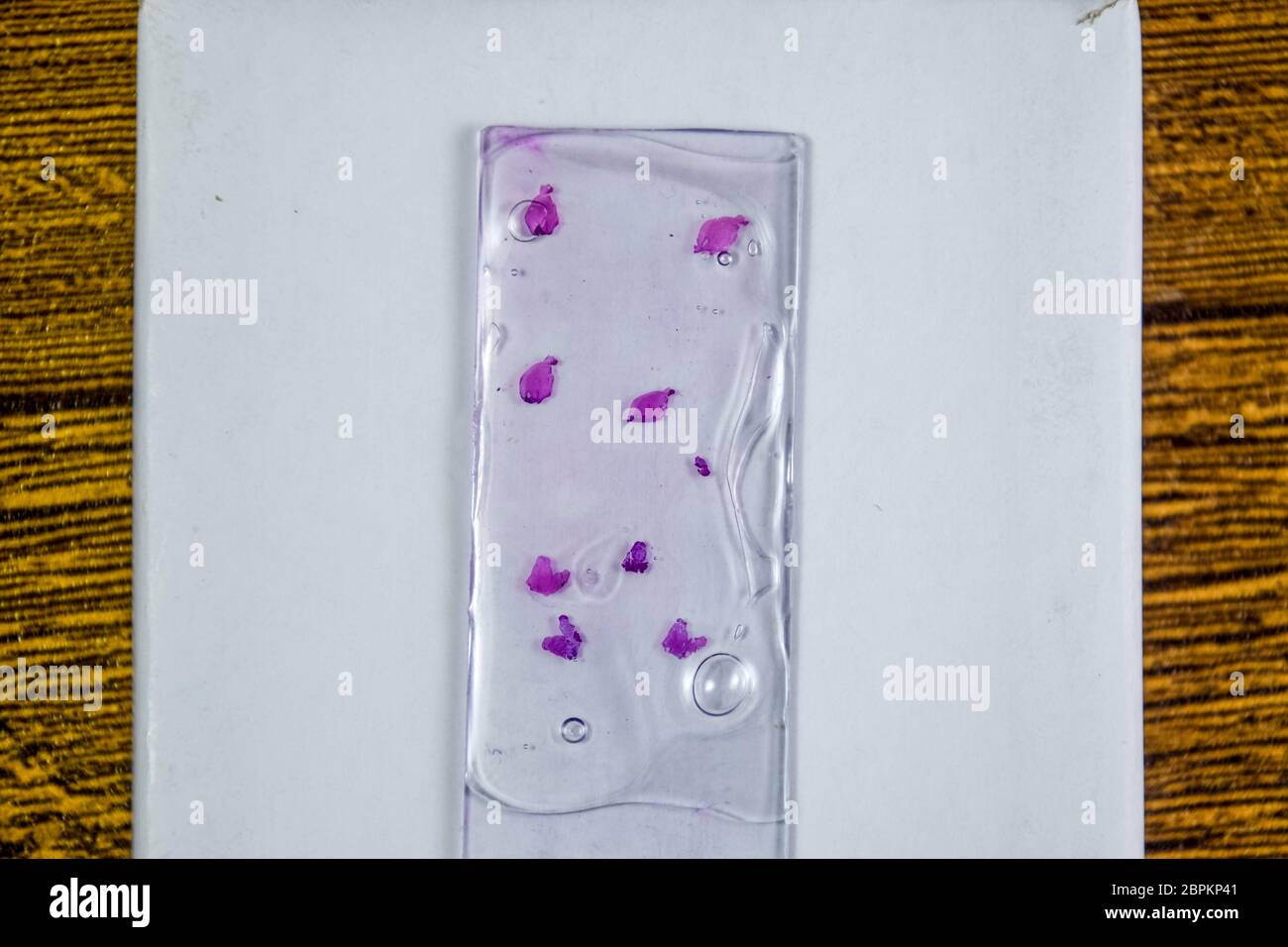 Detection cancer cells analysis hi-res stock photography and images - Alamy