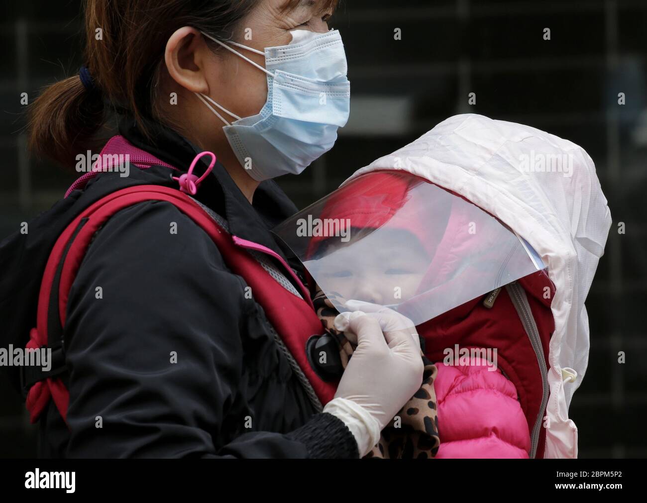 Inflammatory syndrome child hi-res stock photography and images - Alamy