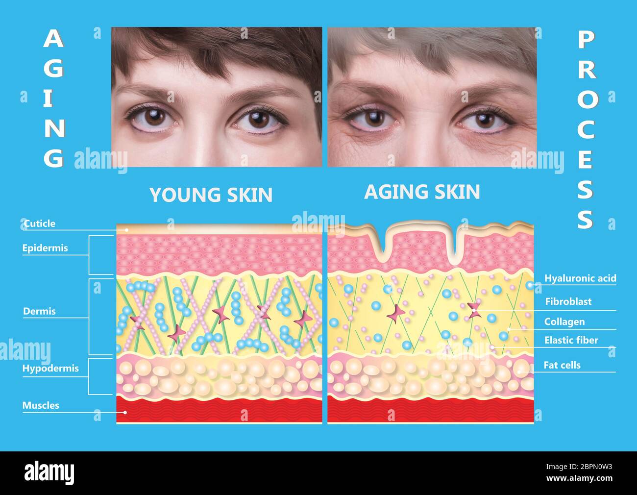 The Younger Skin And Aging Skin Elastin And Collagen A Diagram Of