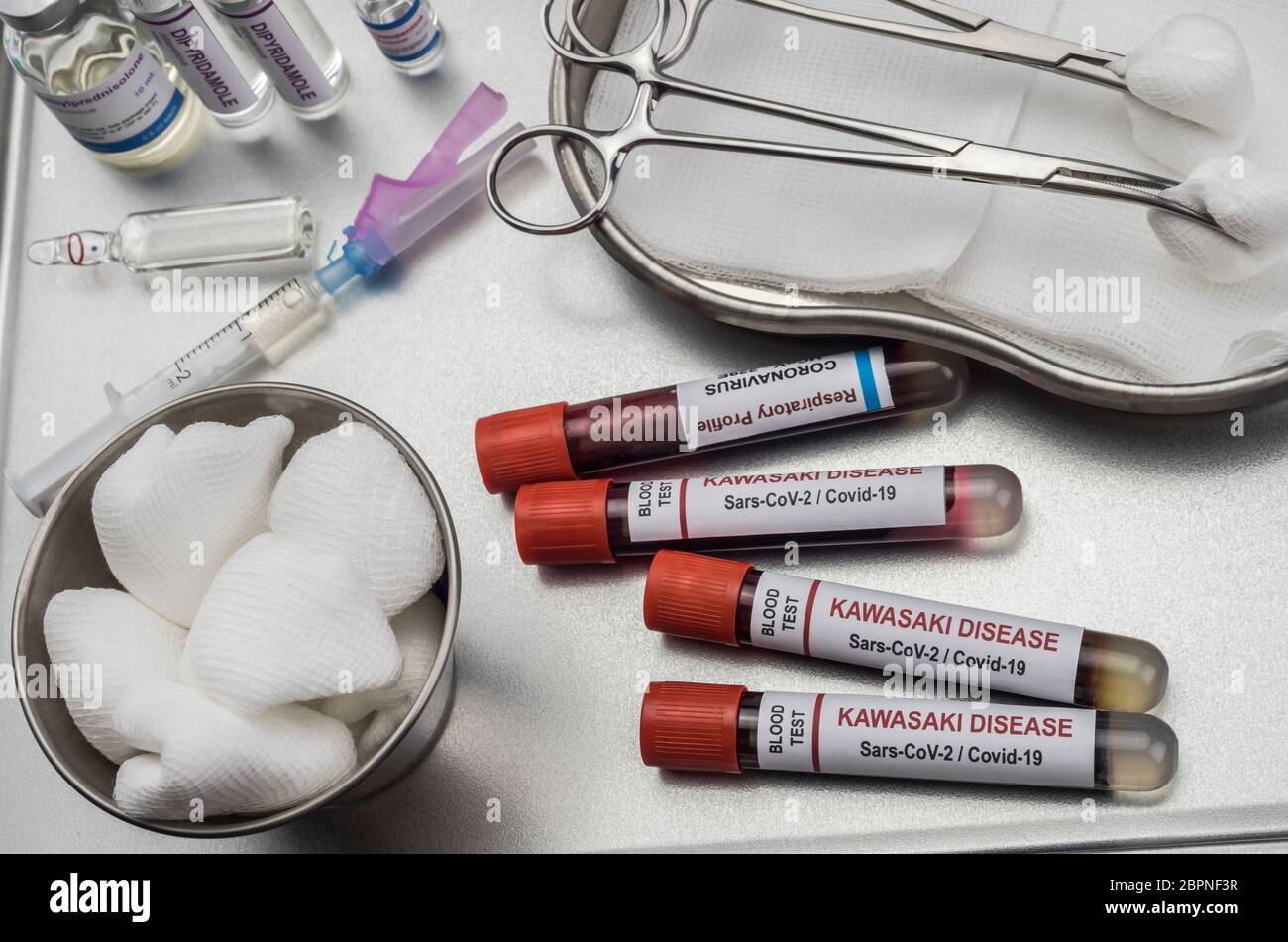 Blood samples to treat Sars-CoV-2-related Kawasaki disease in children ...