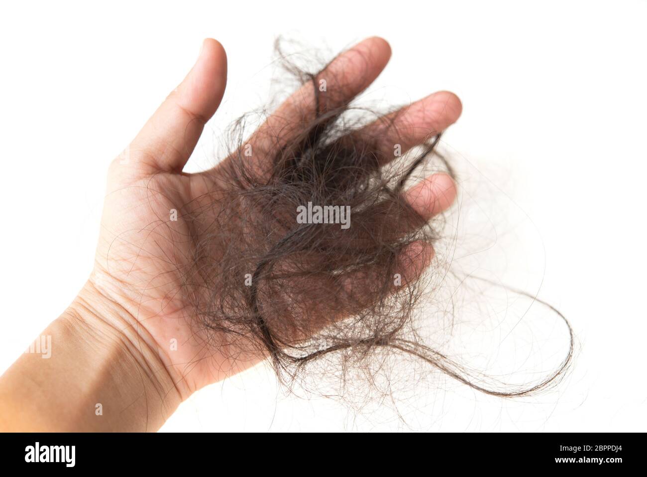 Human hand with lost hair on it, isolated on white background Stock ...