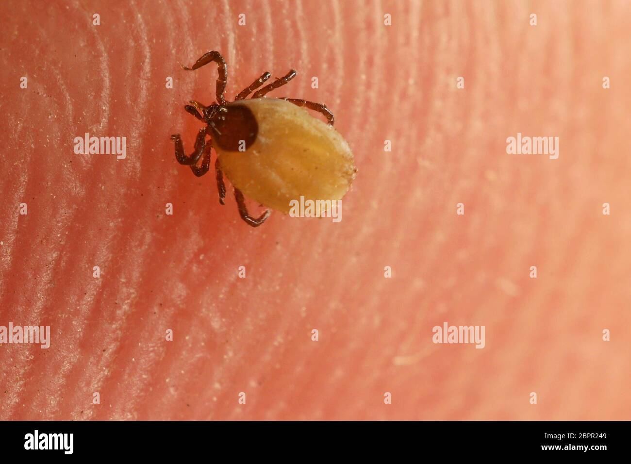 Tick crawling on human skin Stock Photo - Alamy