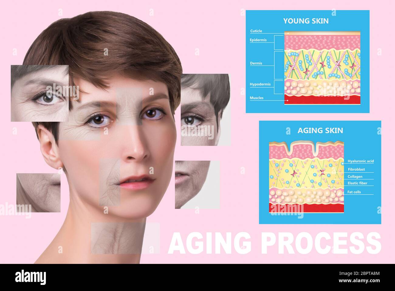 The younger skin and aging skin. elastin and collagen. A diagram of ...