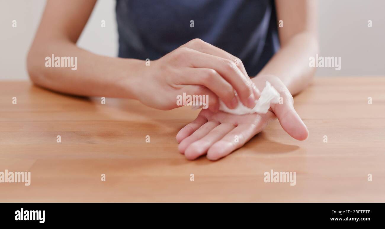 Hyperhidrosis disease hi-res stock photography and images - Alamy