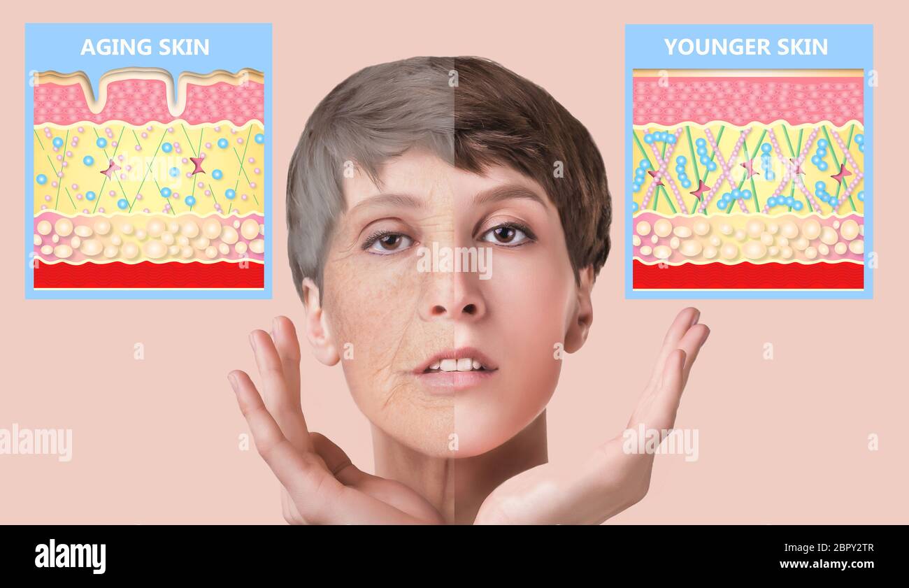 The younger skin and aging skin. elastin and collagen. A diagram of ...