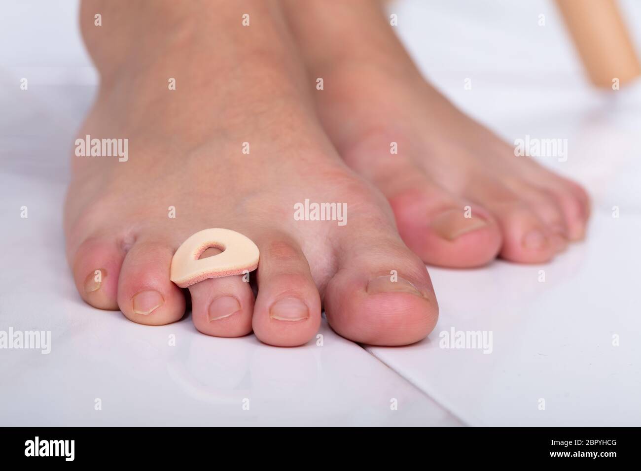 Callus finger hi-res stock photography and images - Alamy