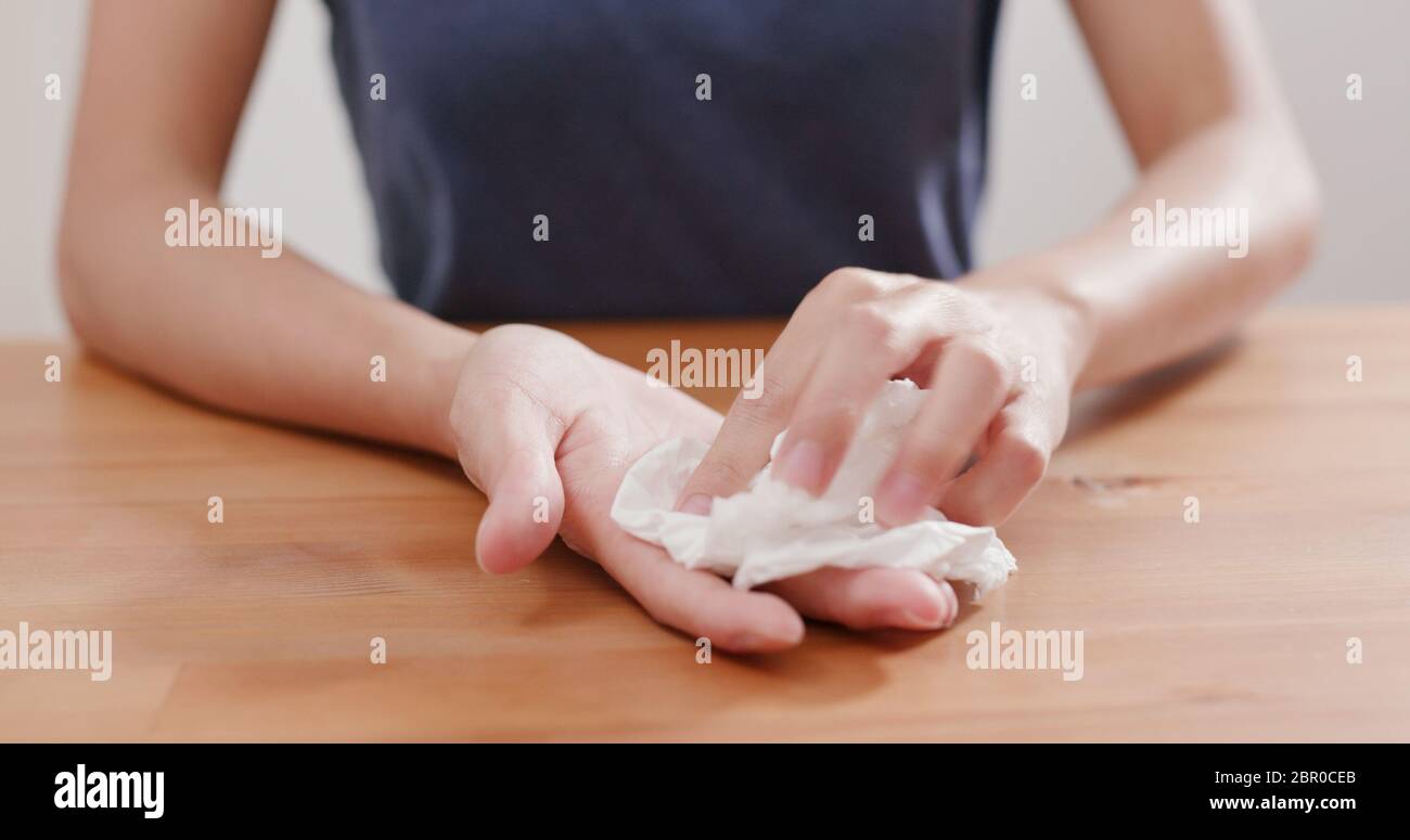 Woman suffer from hand perspiration Stock Photo - Alamy