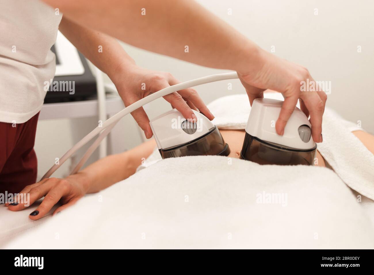 The procedure for vacuum anti-cellulite massage of the abdomen in a ...