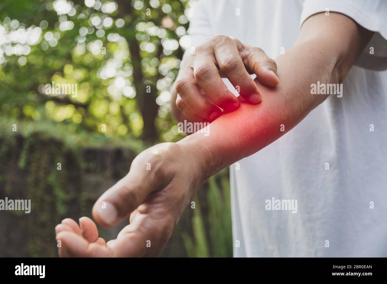 Man scratch itch with hand. Man scratching his hand healthcare concept ...