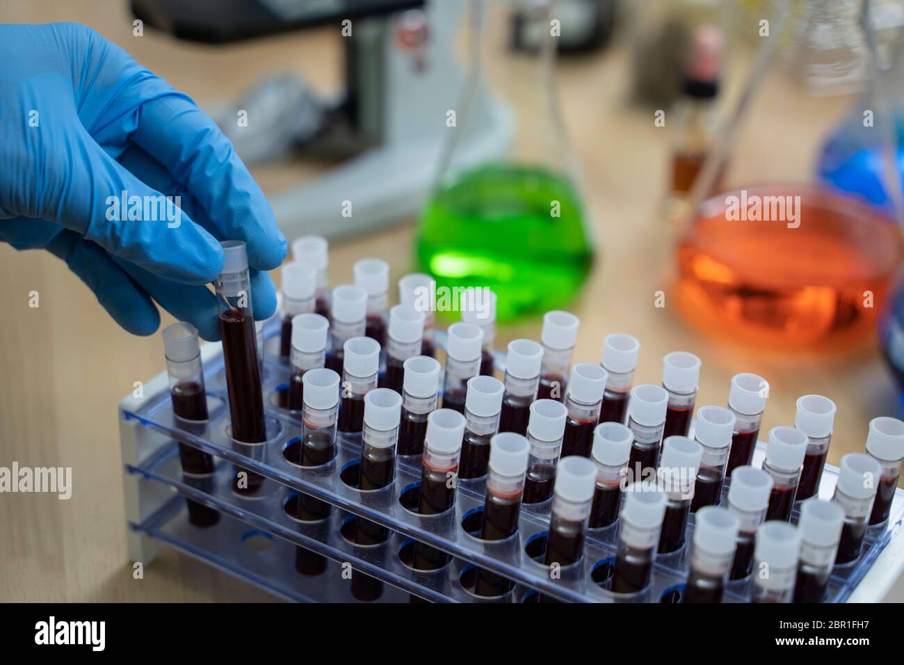 Doctor hand taking a blood sample tube from a rack with machines of ...