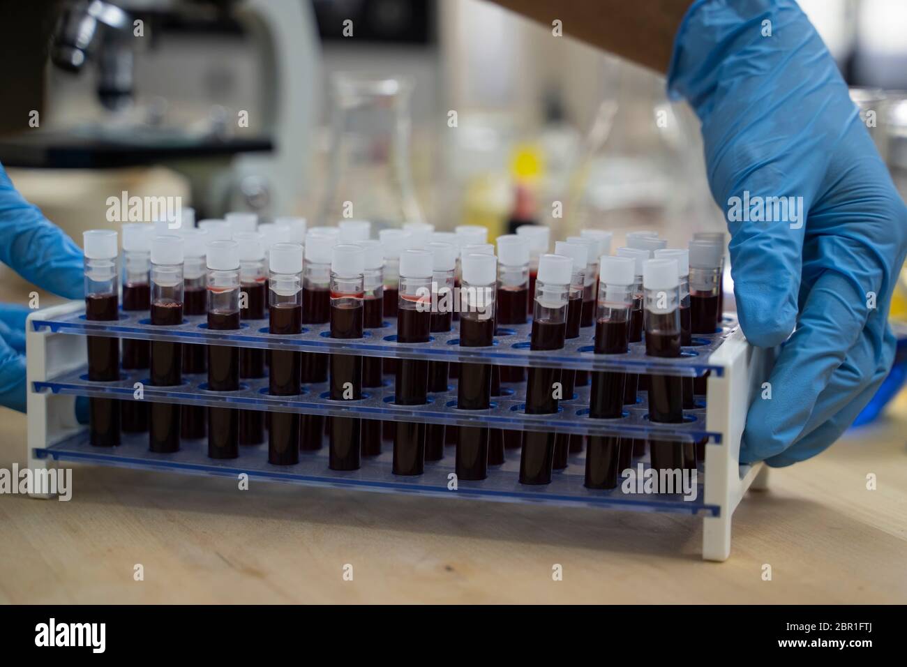 Doctor hand taking a blood sample tube from a rack with machines of ...