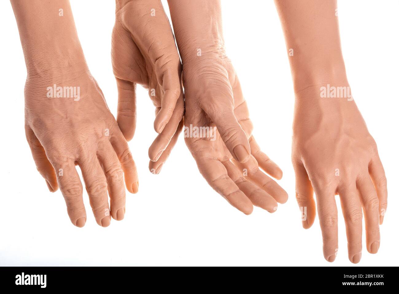 group silicone prosthesis hands, medicine pink implants for person ...
