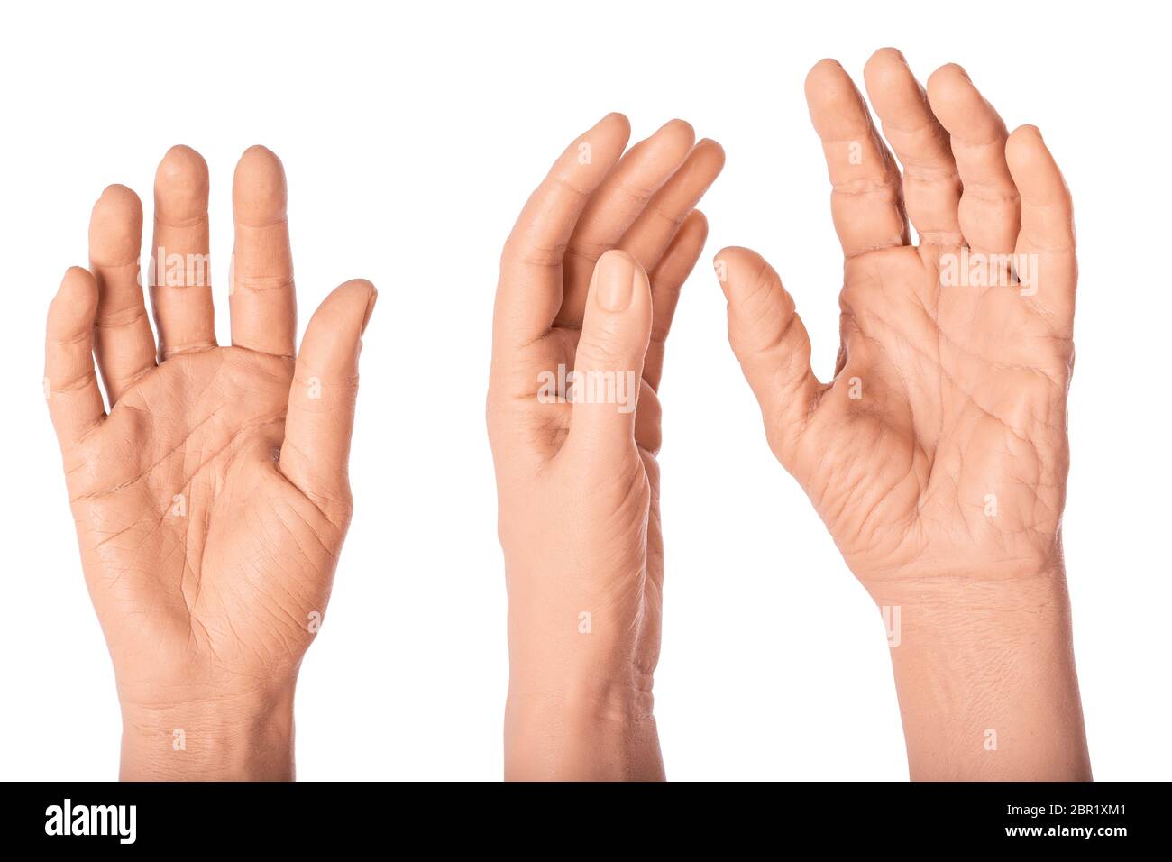 group silicone prosthesis hands, medicine pink implants for person ...