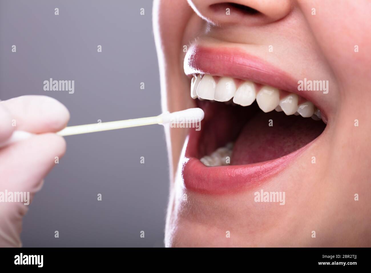 Skin Swab Test High Resolution Stock Photography and Images - Alamy