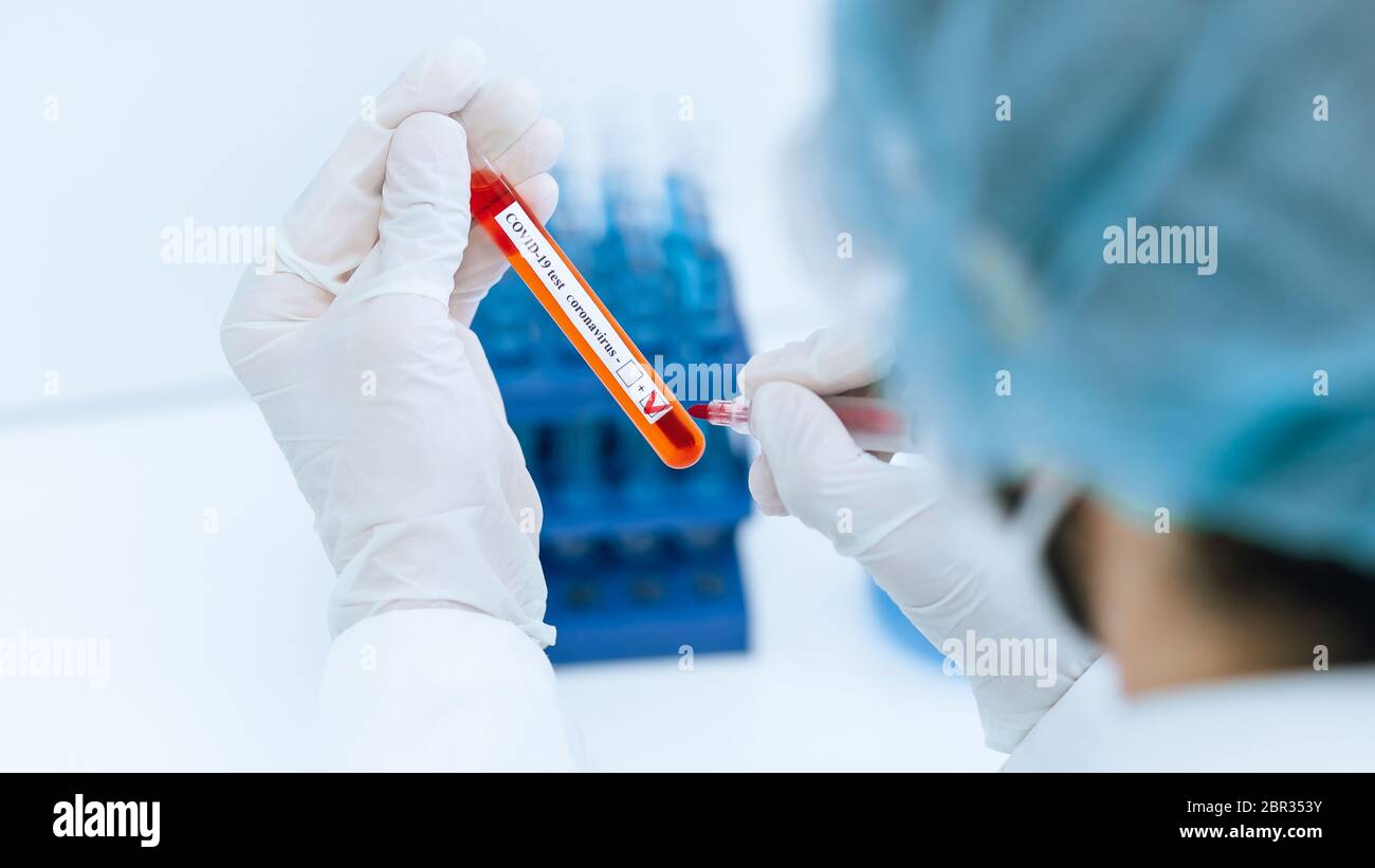 scientist puts a check mark on the tube with the test Stock Photo - Alamy