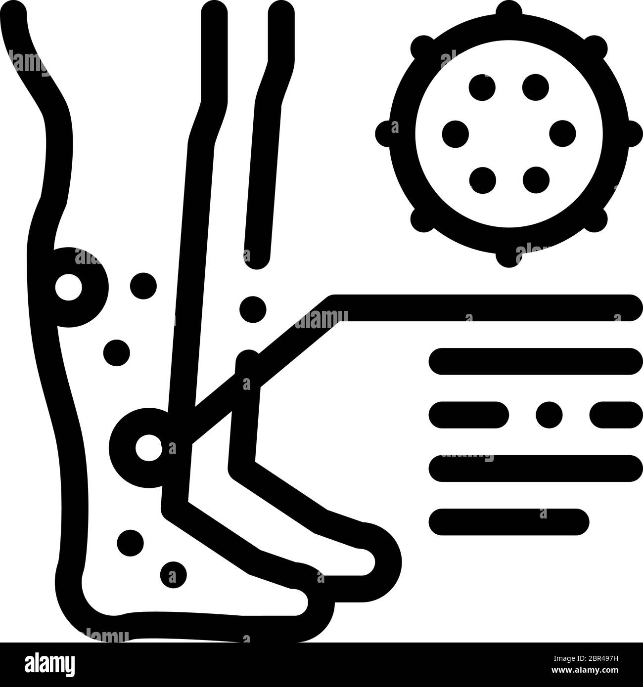 Rash leg Black and White Stock Photos & Images - Alamy