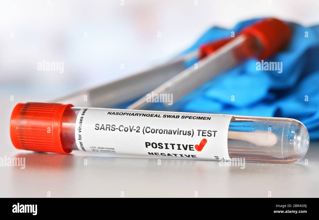 Coronavirus test concept - vial sample tube with cotton swab, red ...